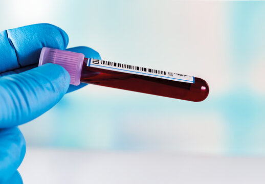 bleeding time and clotting time Test - BT-CT - Sanjeevani Dwarka Path Labs