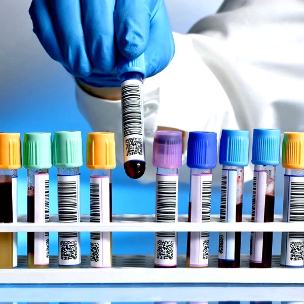 Creatine Phosphokinase-MB (CPK-MB) and the Diagnosis of Myocardial ...